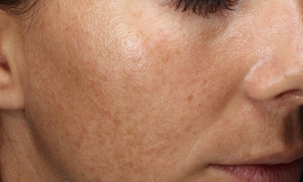 Expert in aesthetic dermatology | Dermaceutic US